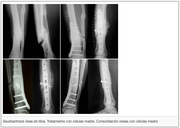 Mother cells - CEMATEC